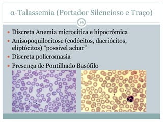 Atlas de alterações e doenças hematológicas - Alberto Galdino | PDF