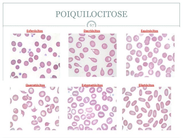 Atlas de alterações e doenças hematológicas Alberto Galdino