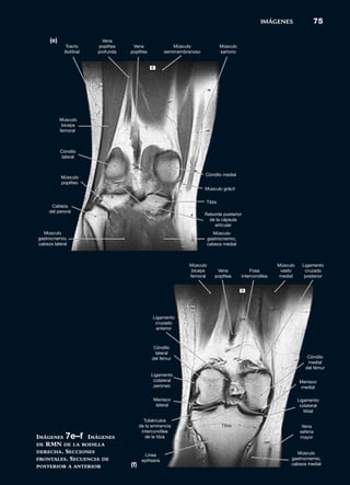 Atlas de anatomia humana | PDF