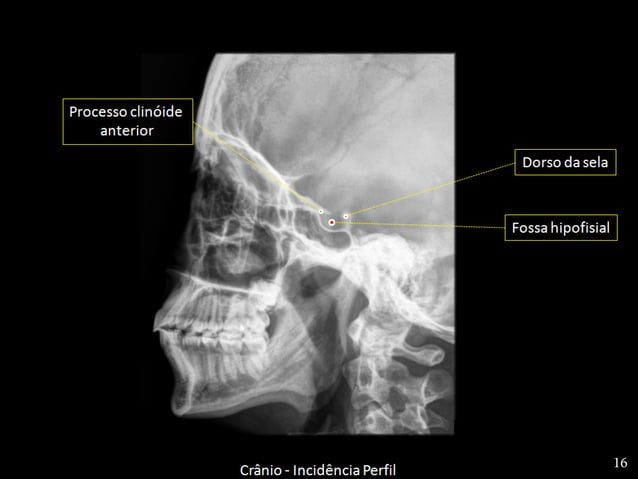 Atlas de anatomia radiográfica.pdf