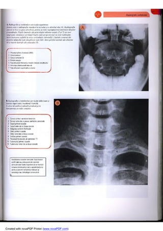 Atlas de anatomie | PDF