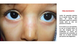 ATLAS DE DERMATOLOGÍA COMPLETO CON IMÁGENES | PDF
