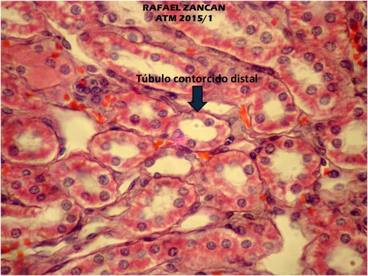 Lamina De Tubulo Contorcido Distal
