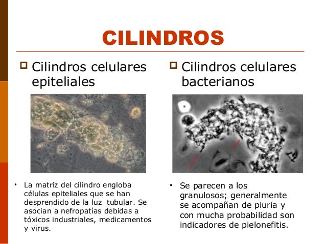 Atlas del sedimento urinario