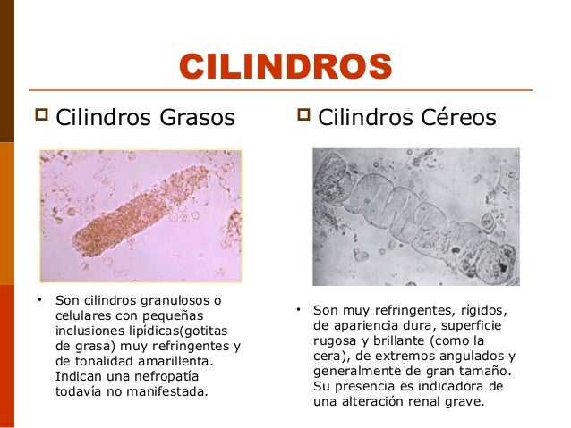 Atlas del sedimento urinario