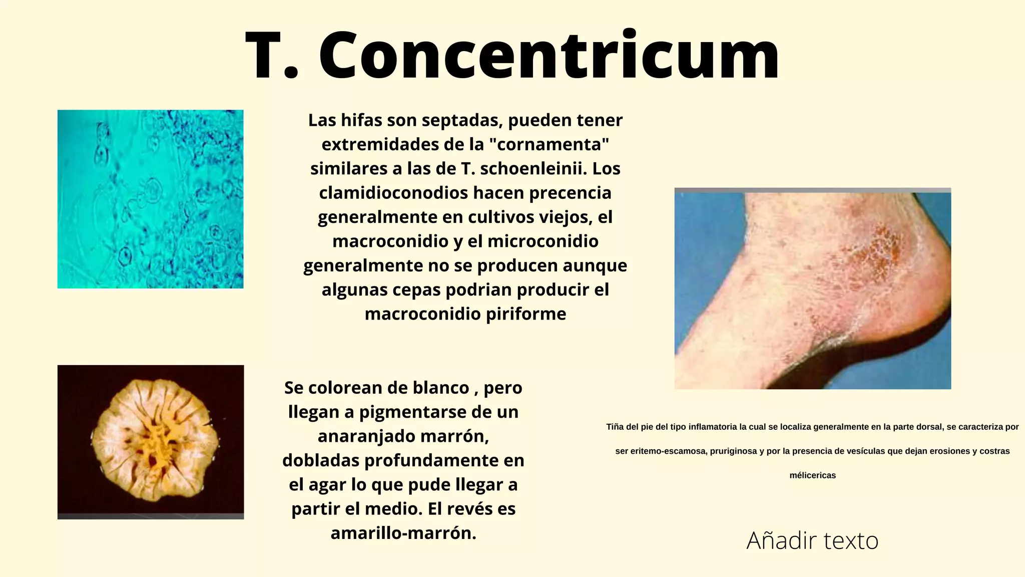 Atlas dermatofitos.pptx