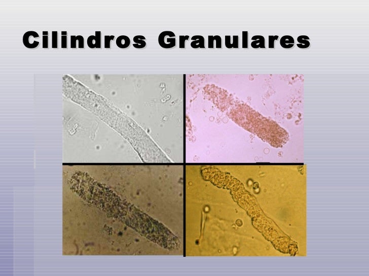 Atlas de uroanálise