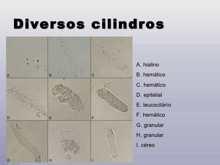 Atlas de uroanálise