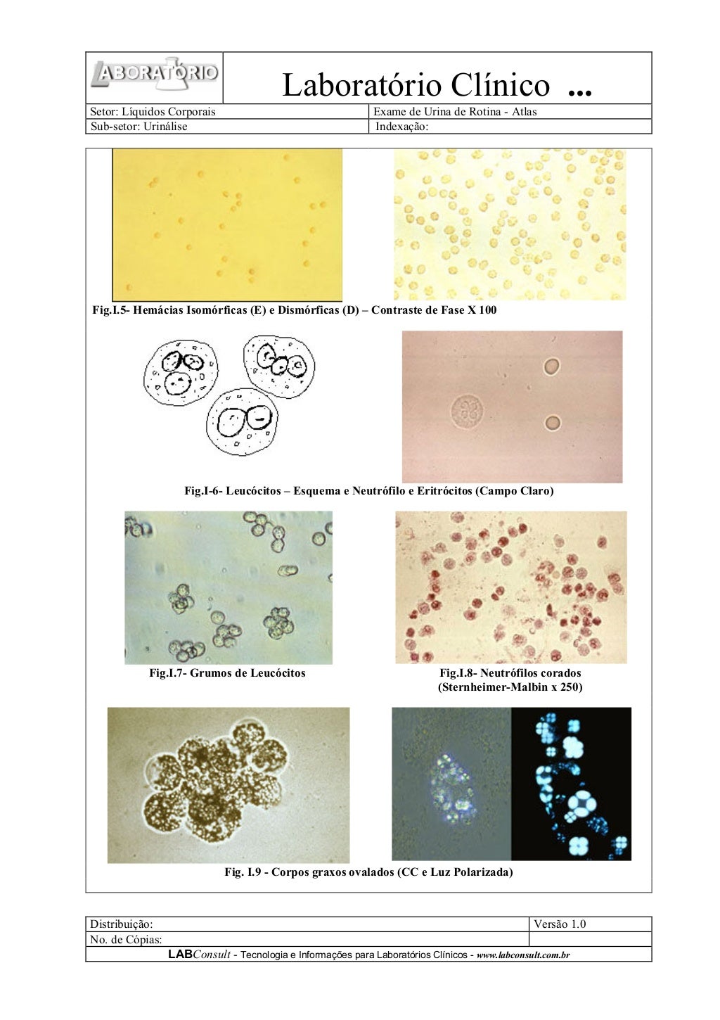 Rotina De Urina Caracteres Físicos Elementos E Sedimentoscopia - RETOEDU