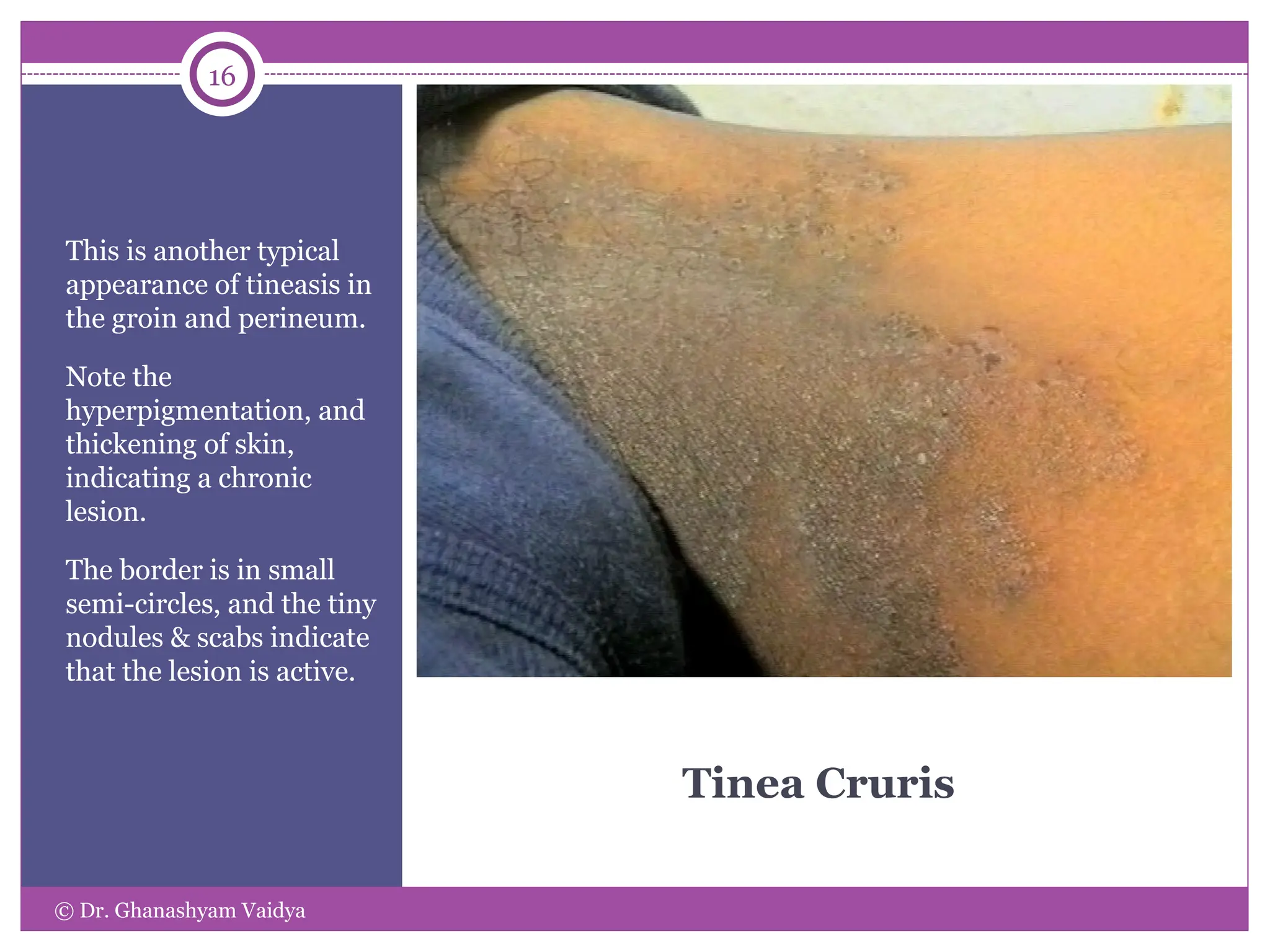 Atlas of skin disorders For General practitioners | PPT