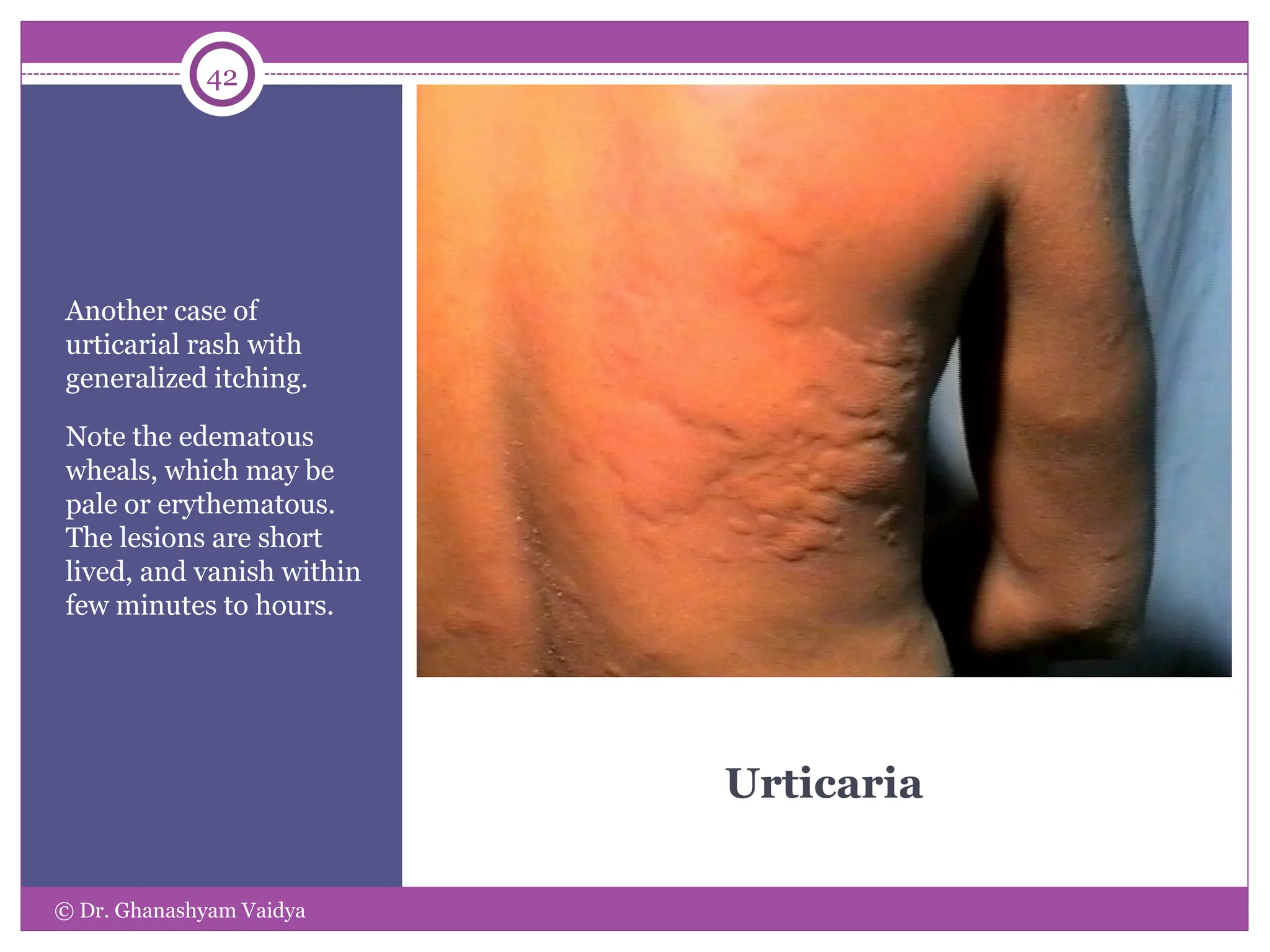 Atlas of skin disorders For General practitioners | PPT