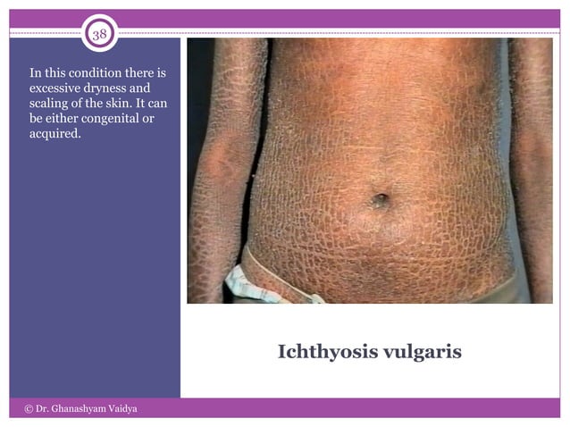 Atlas of skin disorders For General practitioners | PPT