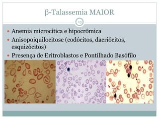 Atlas hematologico alterações hematologicas | PDF