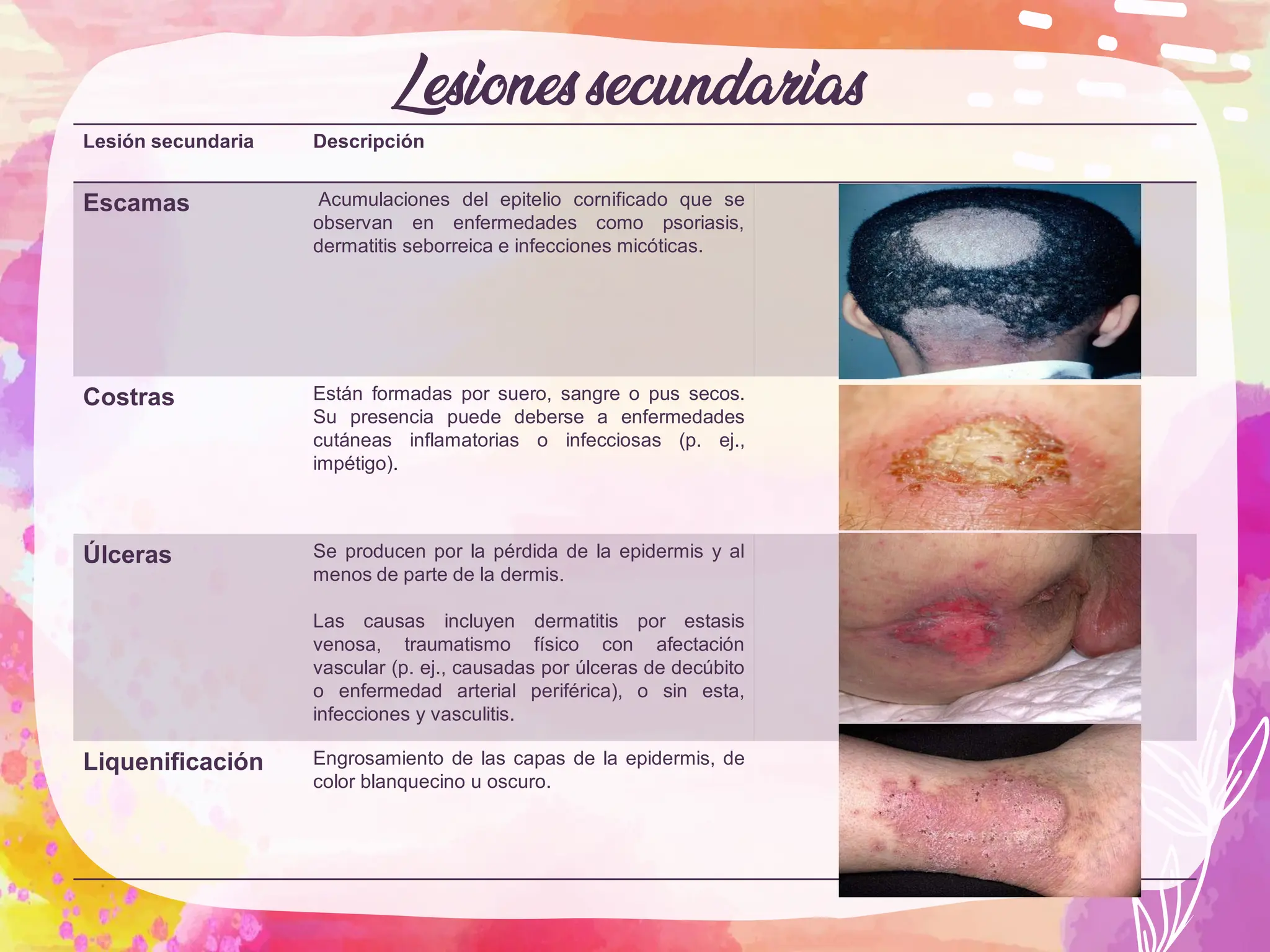 ATLAS LESIONES ELEMENTALES DERMATOLÓGICAS.pdf