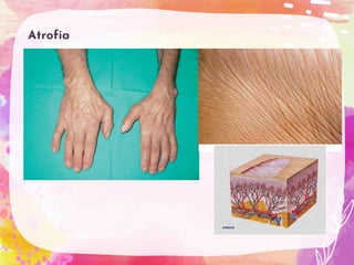 ATLAS LESIONES ELEMENTALES DERMATOLÓGICAS.pdf
