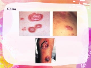 ATLAS LESIONES ELEMENTALES DERMATOLÓGICAS.pdf
