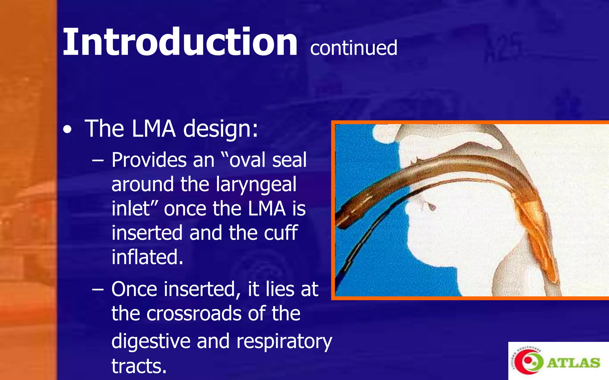 Laryngeal Mask Airway & Igel - An Introduction | PDF