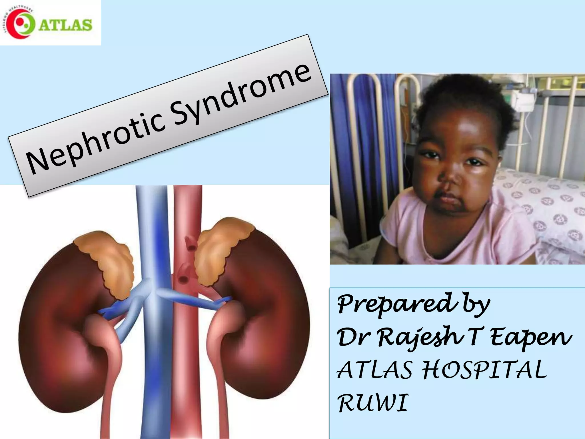 Nephrotic Syndrome | PPTX