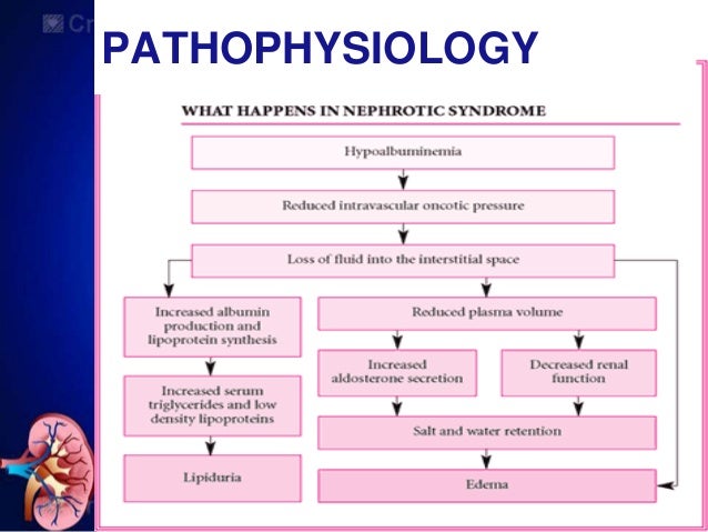 Nephrotic Syndrome
