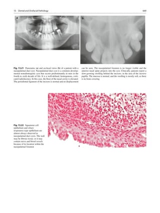 Atlas of anatomic pathology with imaging | PDF