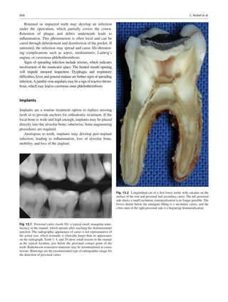 Atlas of anatomic pathology with imaging | PDF