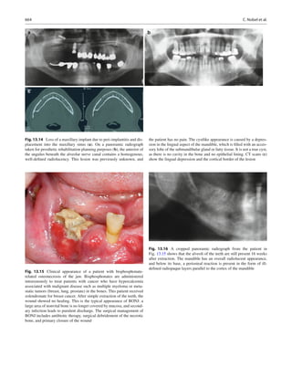 Atlas of anatomic pathology with imaging | PDF