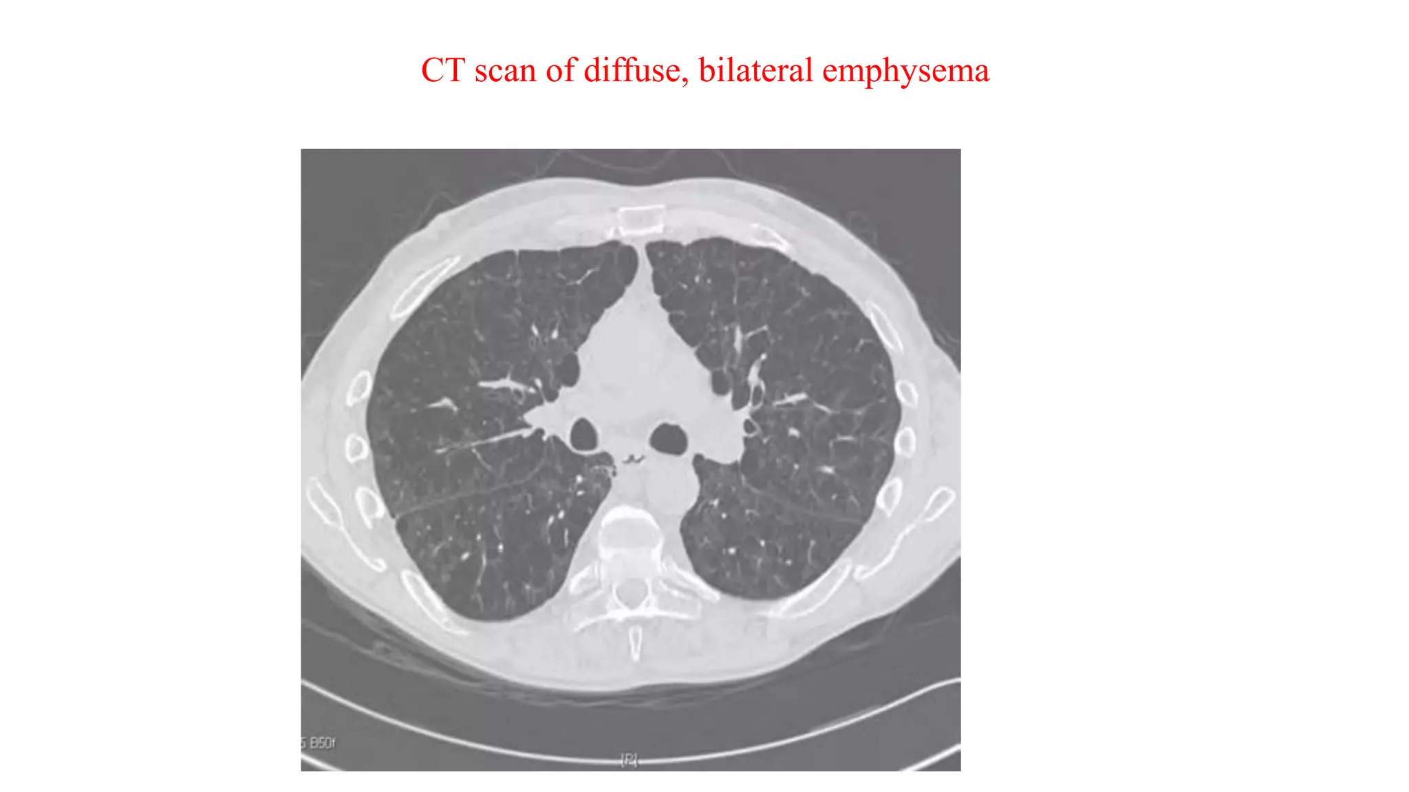 Atlas of chest imaging | PPT