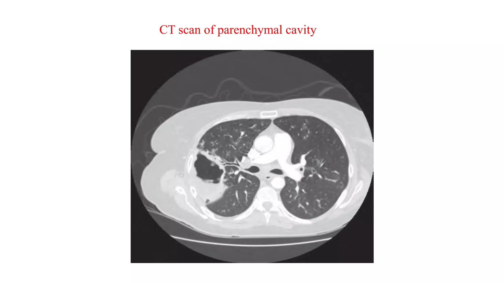 Atlas of chest imaging | PPT