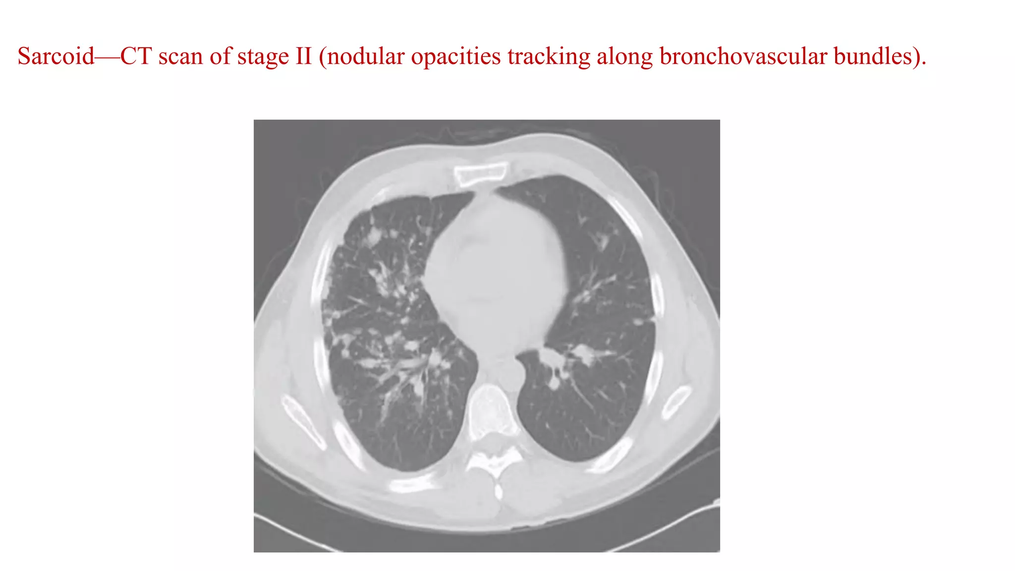 Atlas of chest imaging | PPT