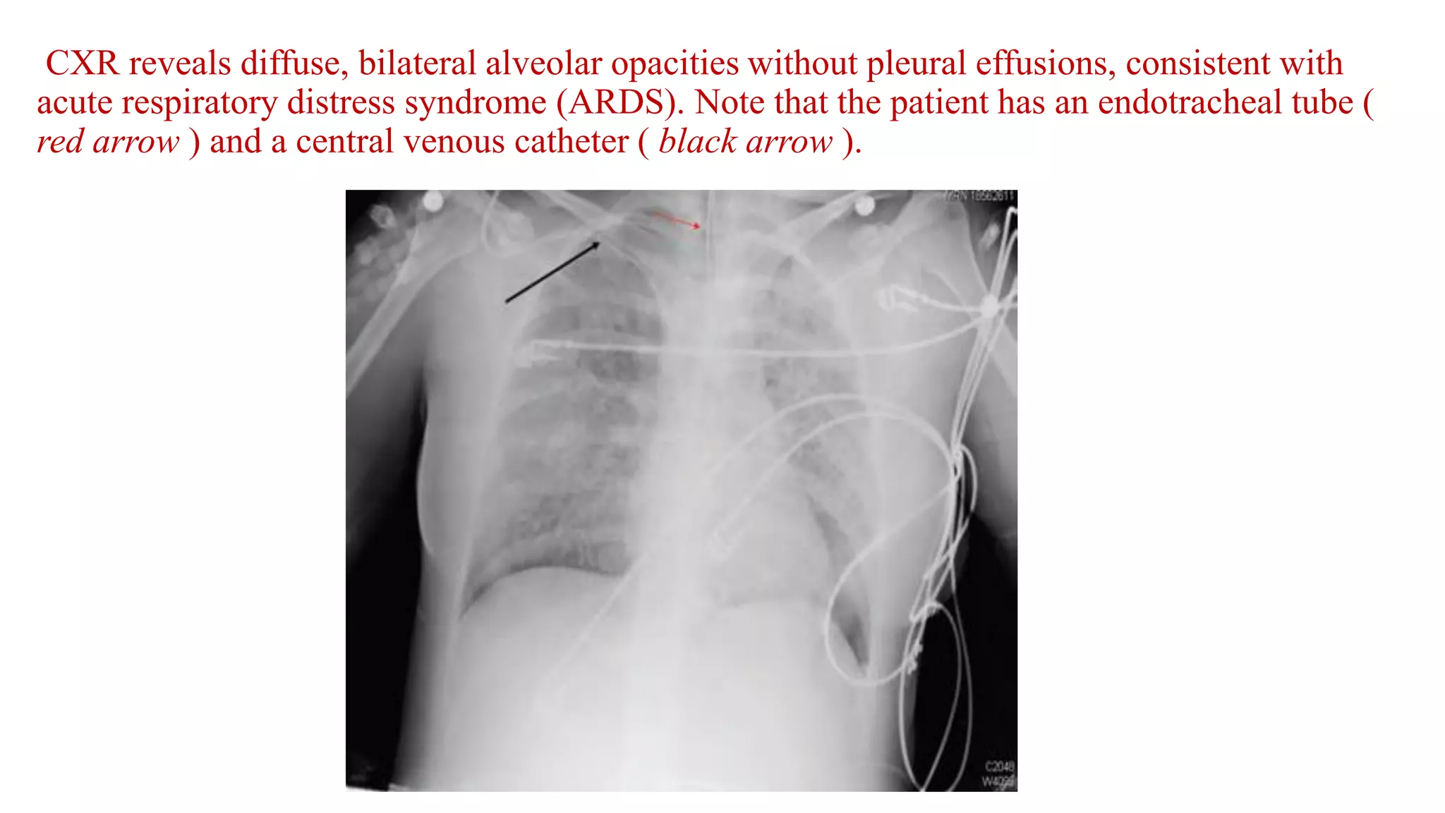 Atlas of chest imaging | PPT