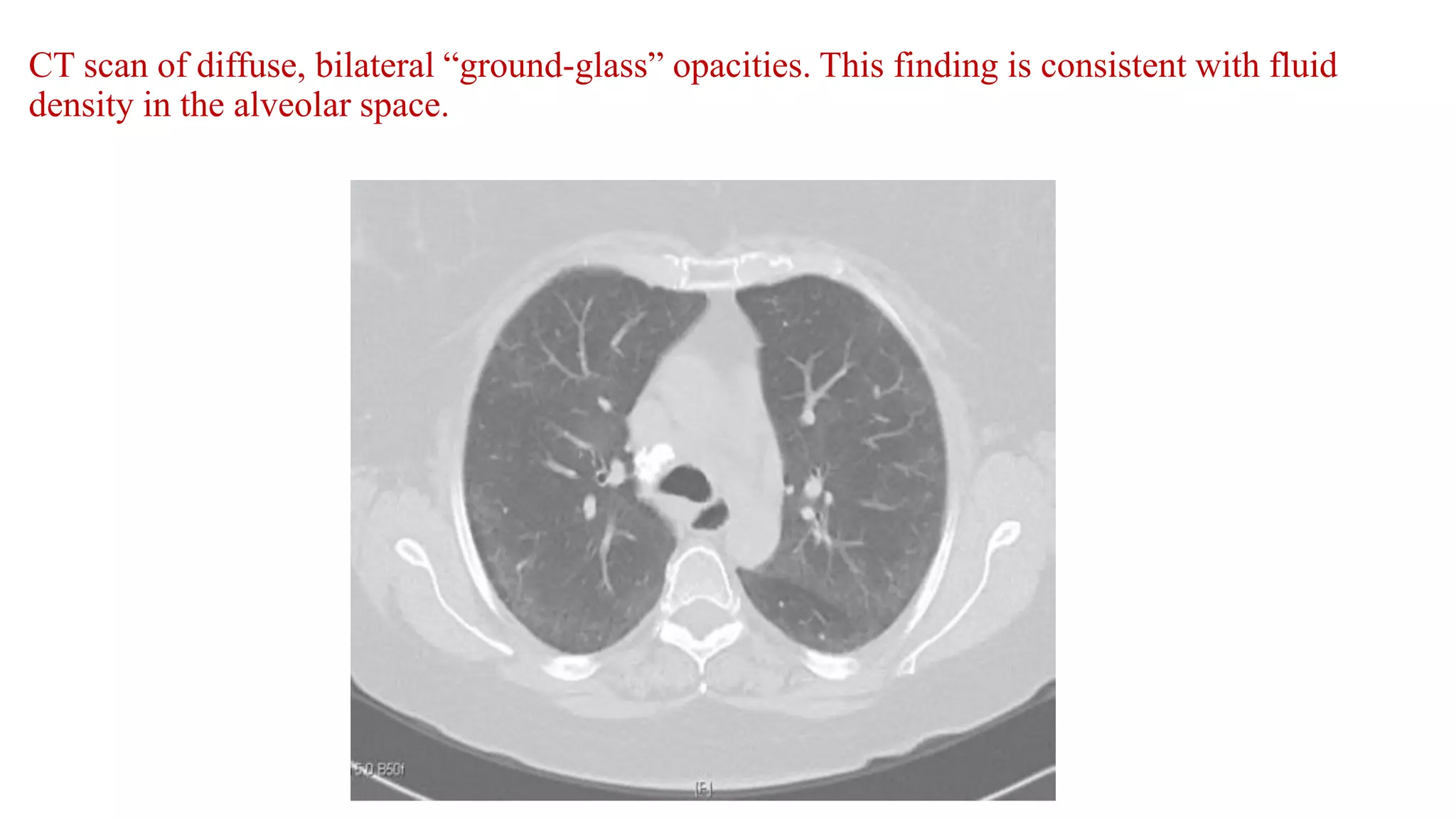 Atlas of chest imaging | PPT