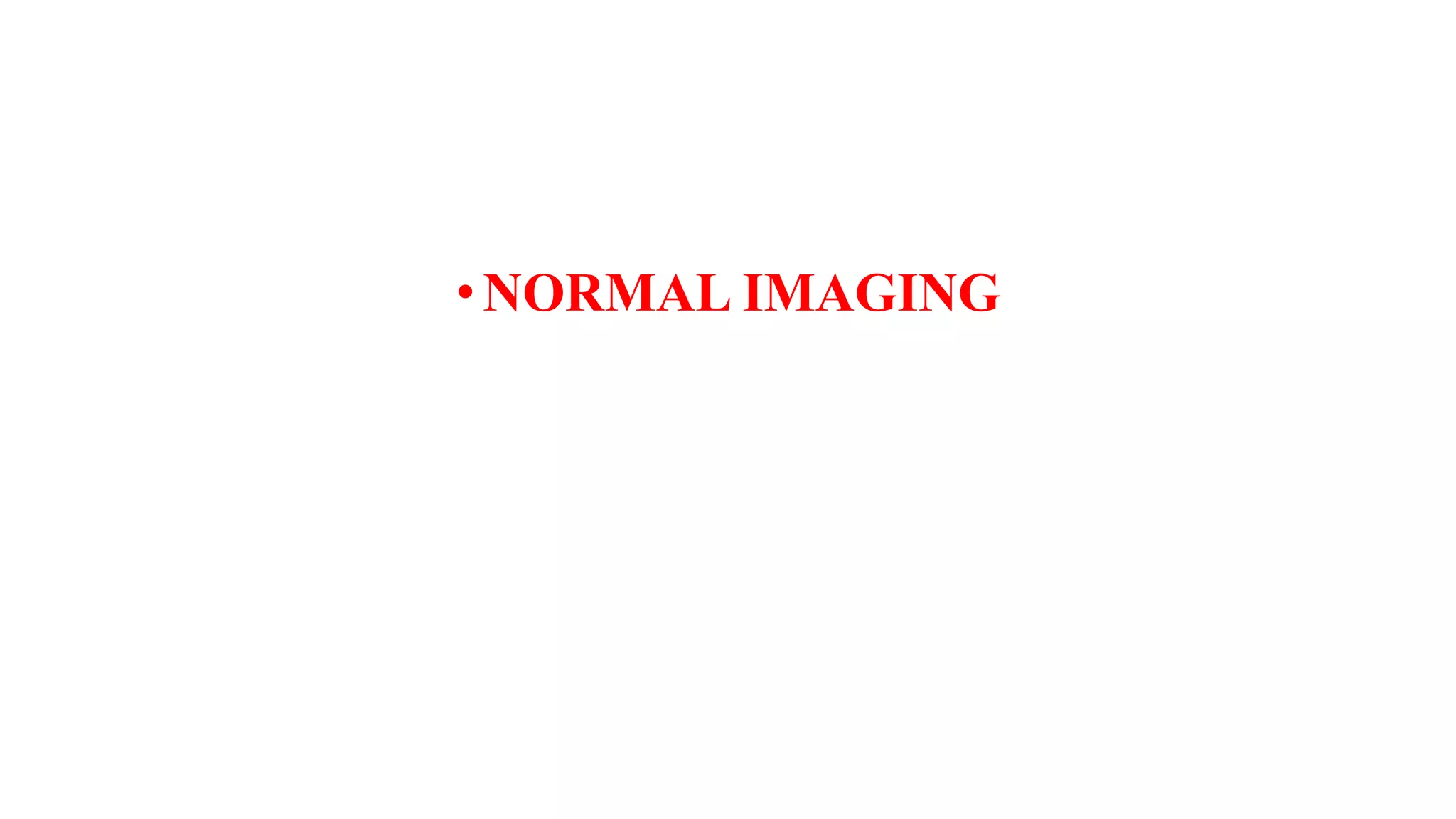 Atlas of chest imaging | PPT