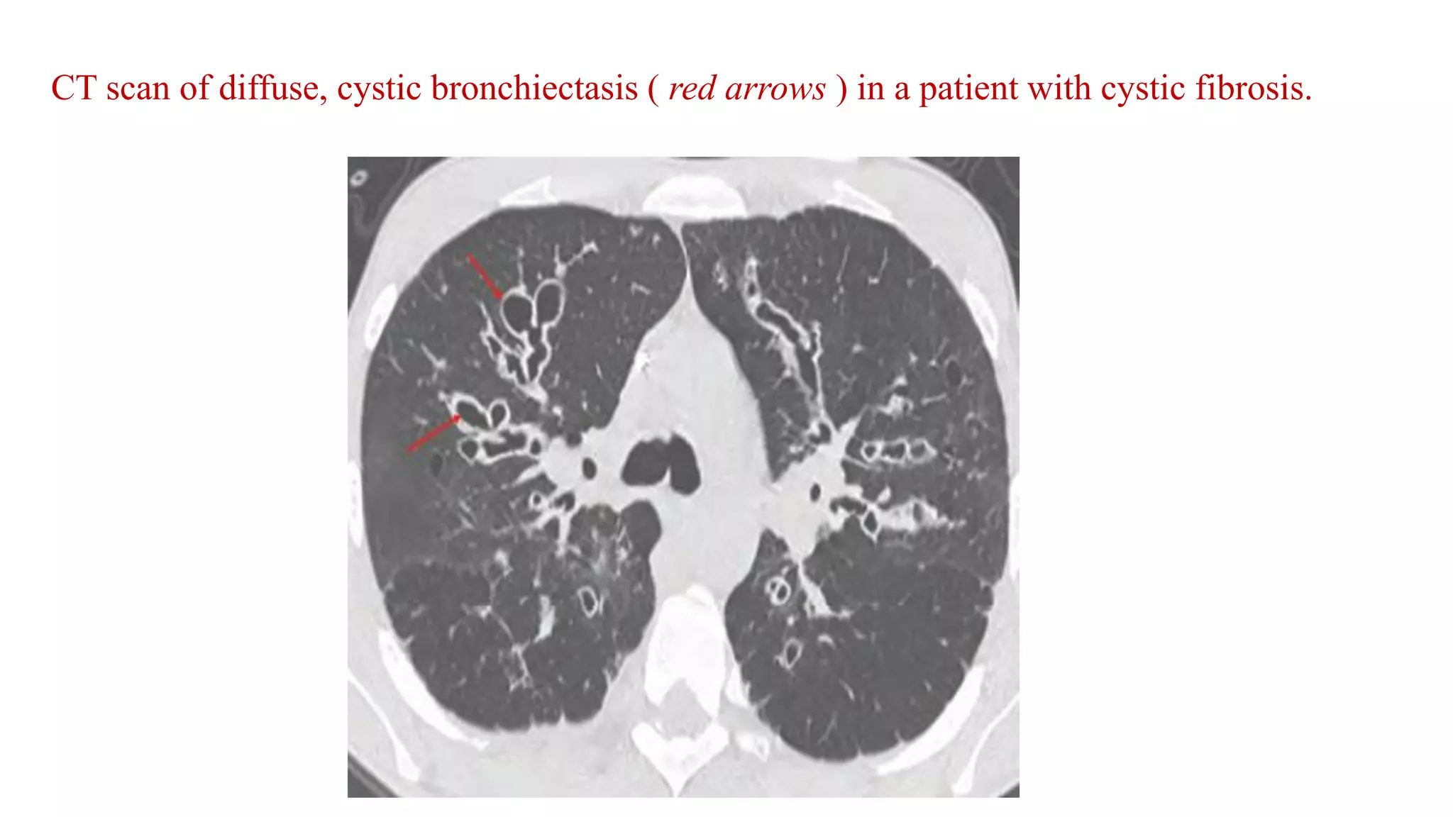 Atlas of chest imaging | PPT