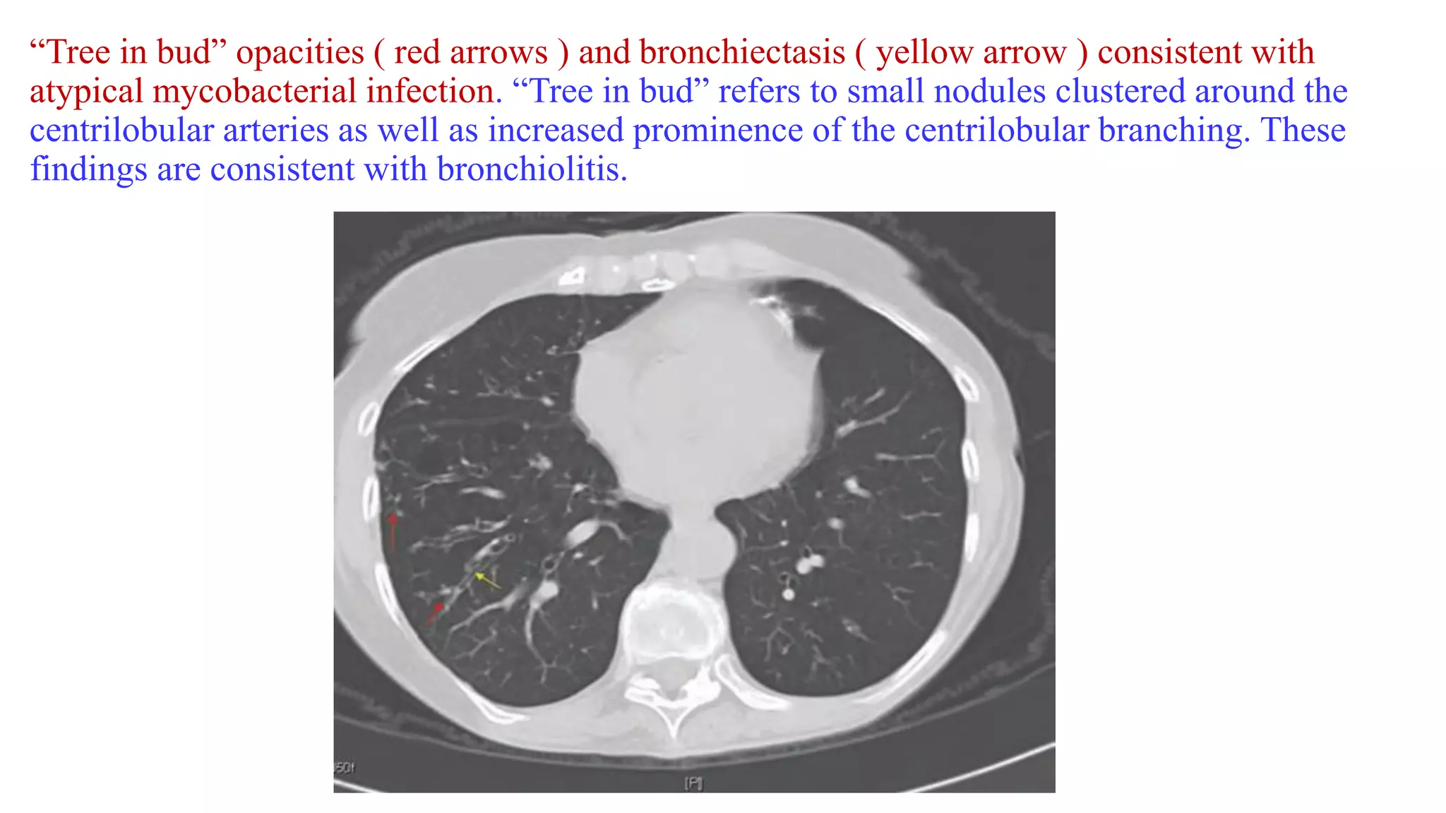 Atlas of chest imaging | PPT