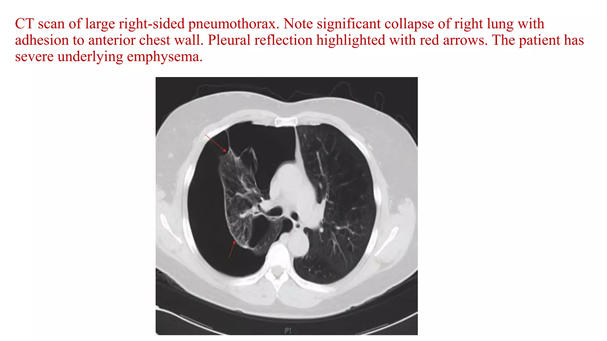 Atlas of chest imaging | PPT
