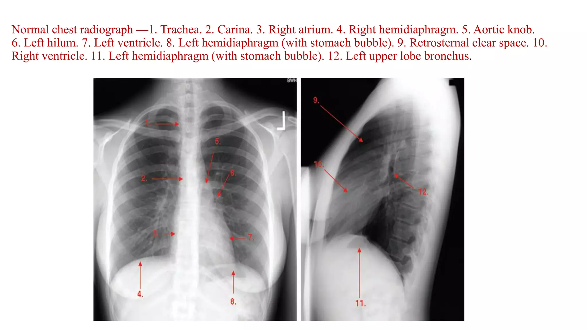 Atlas of chest imaging | PPT