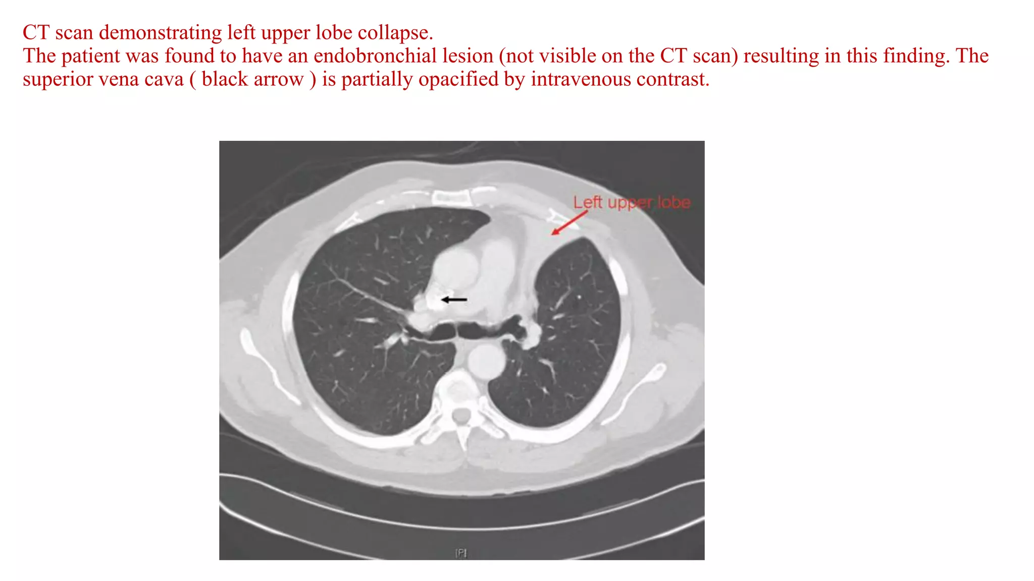 Atlas of chest imaging | PPT