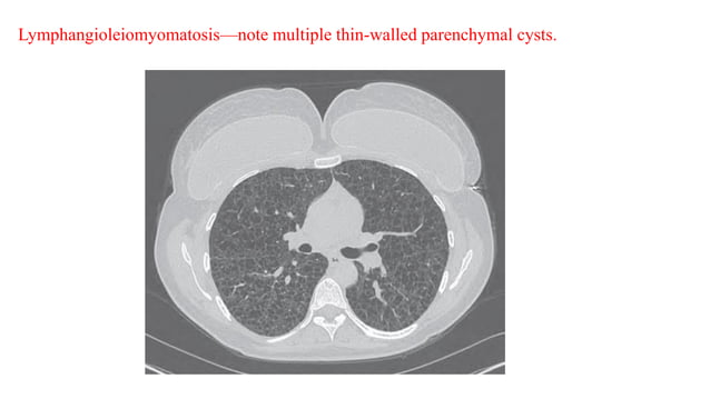 Atlas of chest imaging | PPT