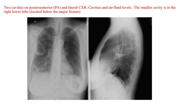 Atlas of chest imaging | PPT