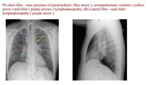Atlas of chest imaging | PPT