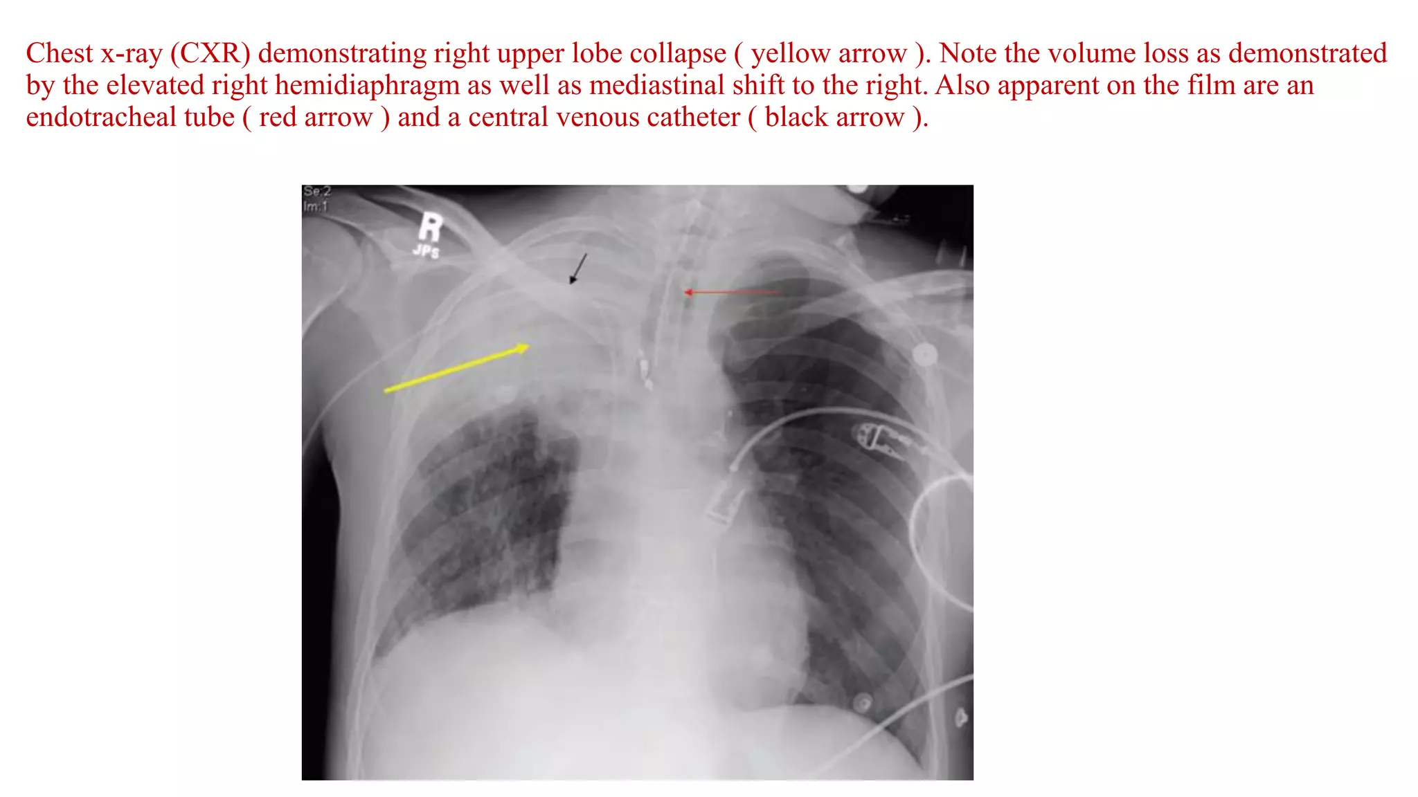 Atlas of chest imaging | PDF