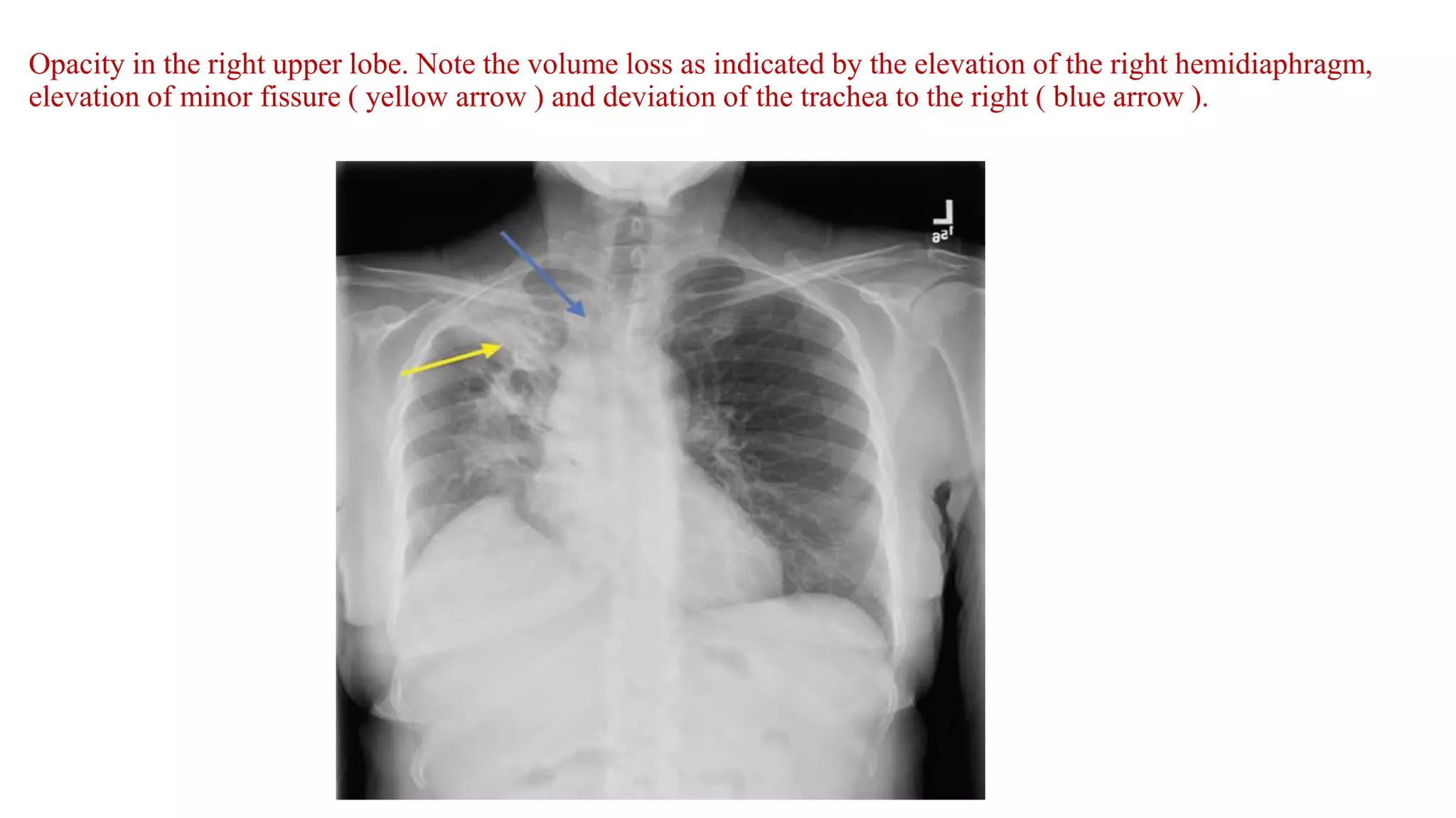 Atlas of chest imaging | PDF