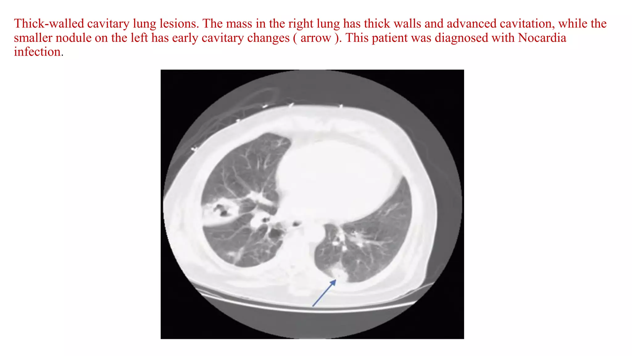 Atlas of chest imaging | PDF