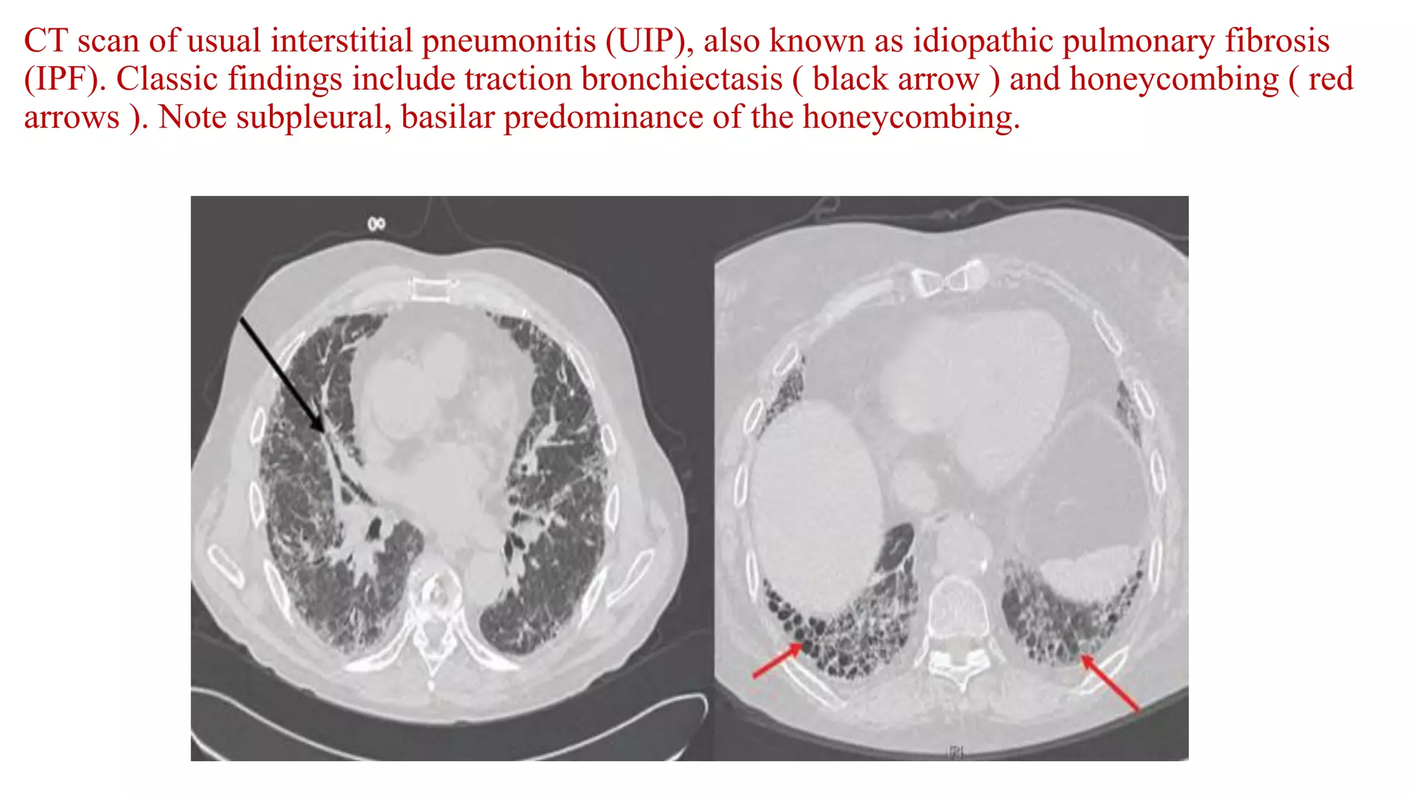 Atlas of chest imaging | PDF