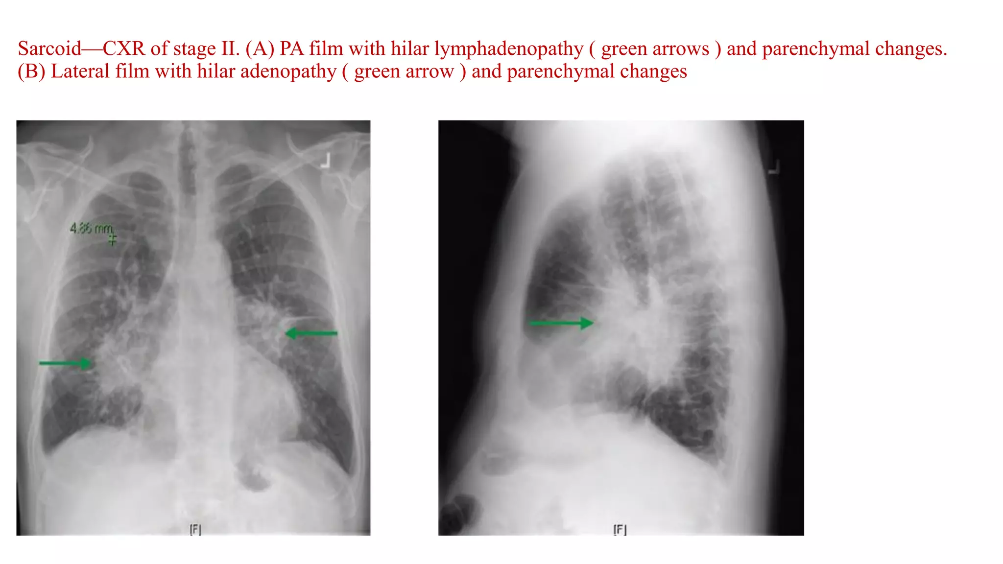 Atlas of chest imaging | PDF