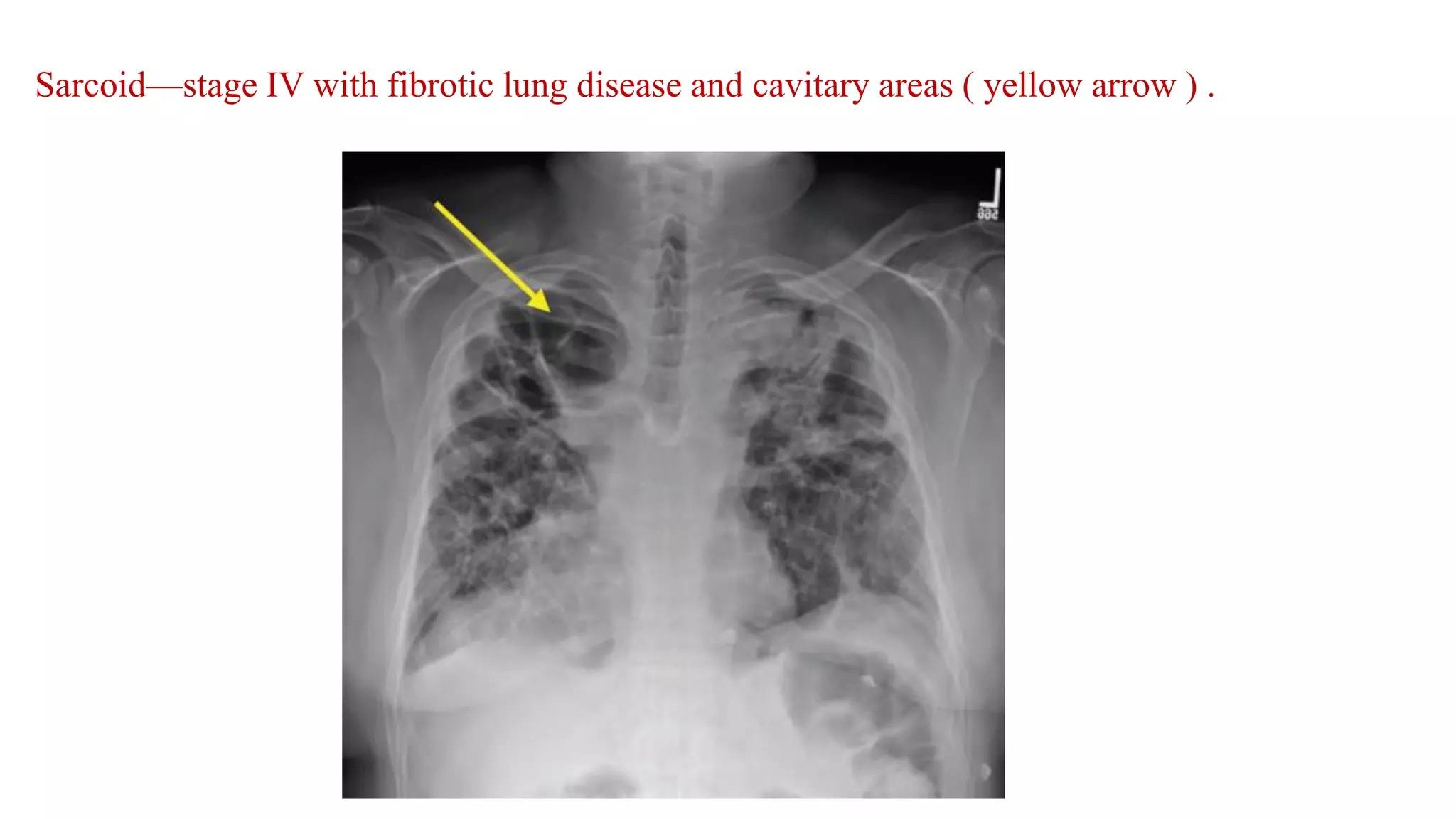 Atlas of chest imaging | PDF