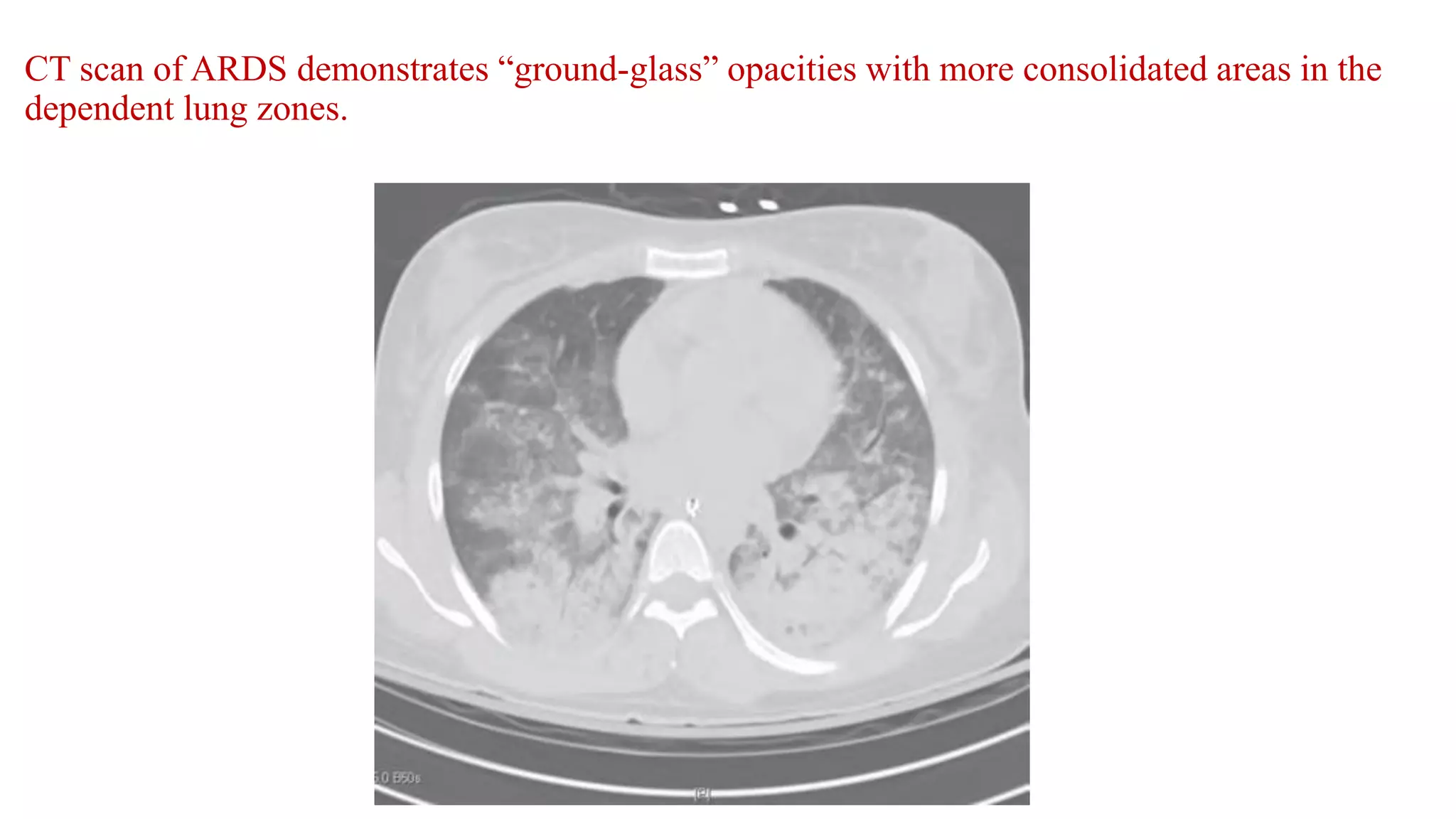Atlas of chest imaging | PDF