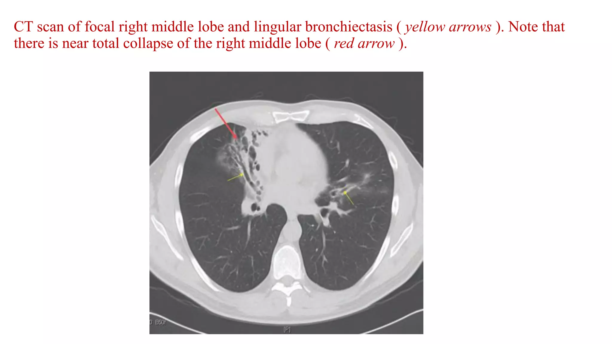Atlas of chest imaging | PDF