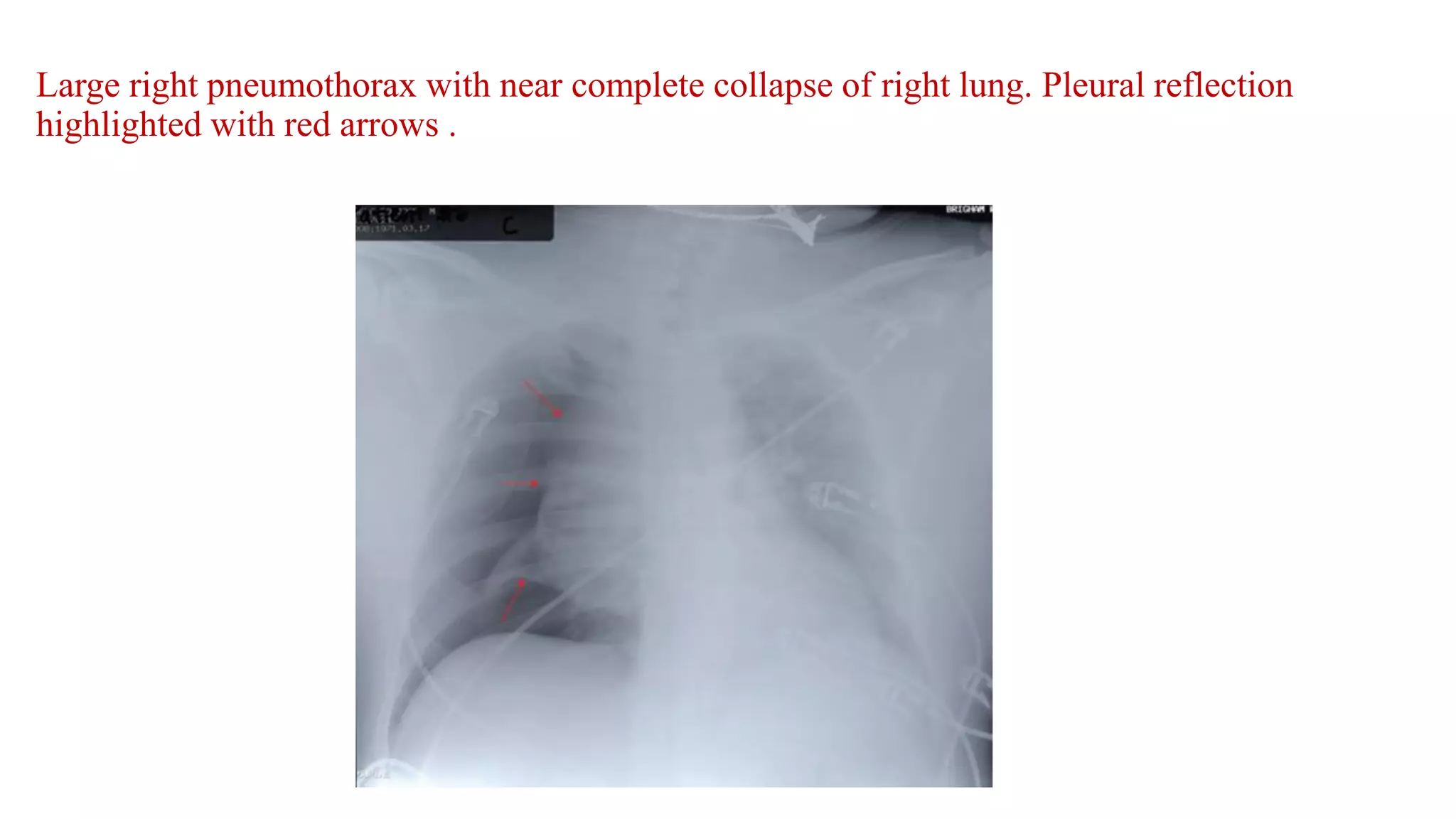 Atlas of chest imaging | PDF