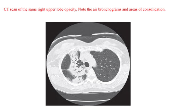 Atlas of chest imaging | PDF
